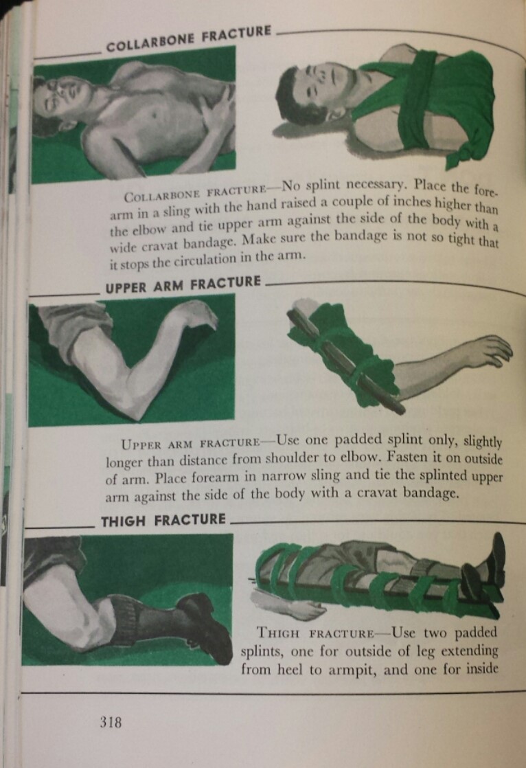 Improvised Splints - EMS Museum